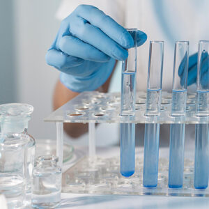 FibroTest – NASH-FibroTest y FibroTest